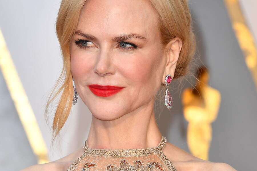 Qu'est-il arrivé au visage de Nicole Kidman ? - Voici
