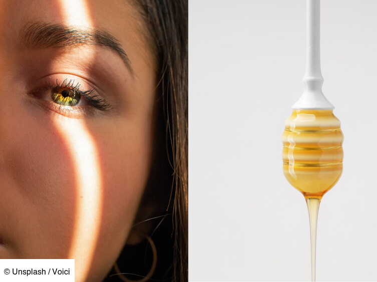 DIY : Une recette maison pour agir sur vos rougeurs et boutons - Voici