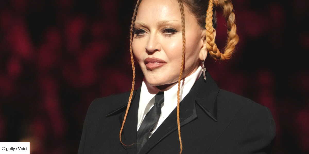 PHOTO Madonna méconnaissable aux Grammy : « Il n’y a pas que du botox ...