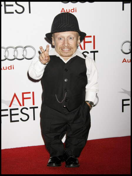 Que deviennent les stars de la saga Harry Potter ? - Voici